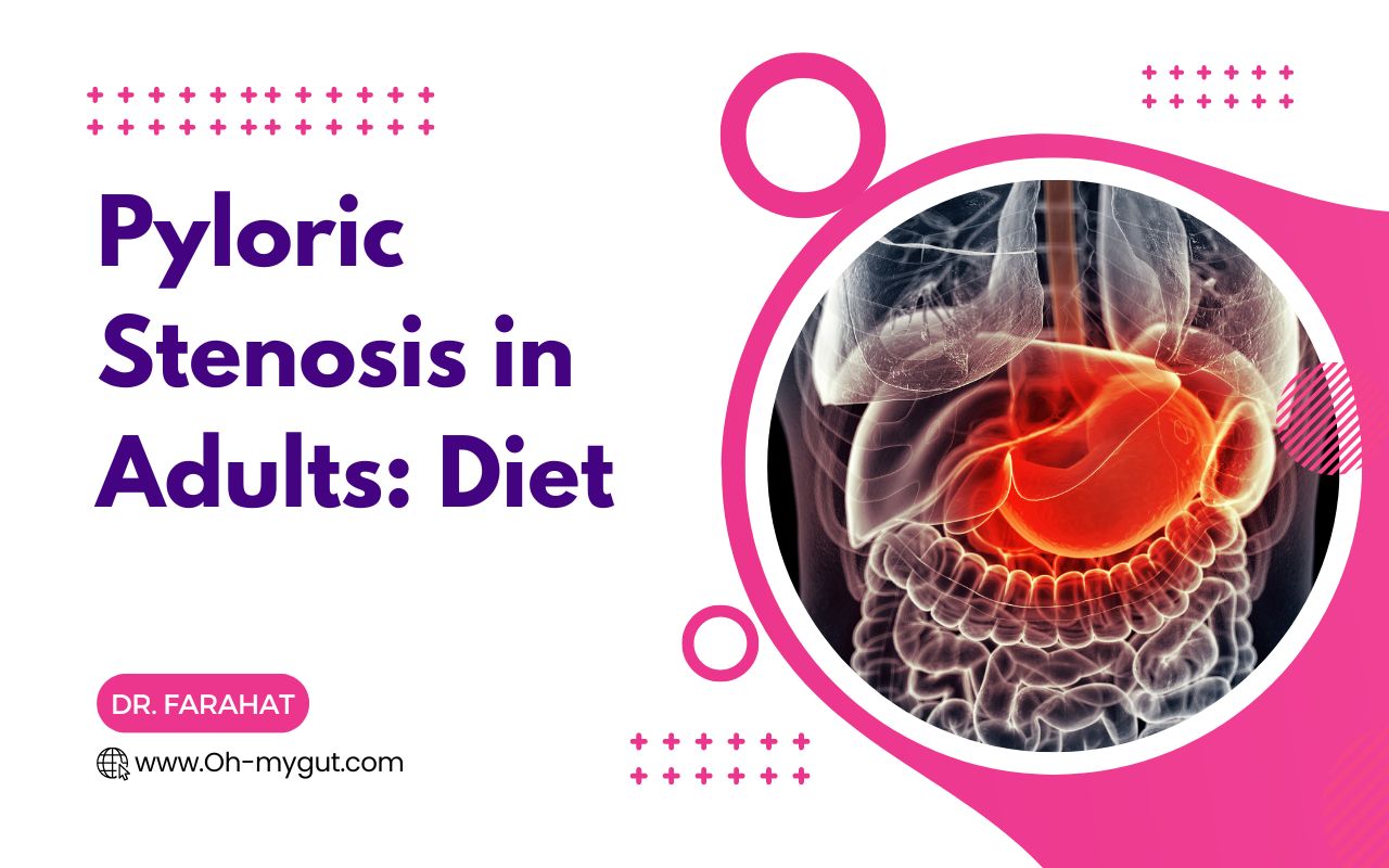 Diet for Pyloric Stenosis in Adults: A Comprehensive Guide + Recipies ...