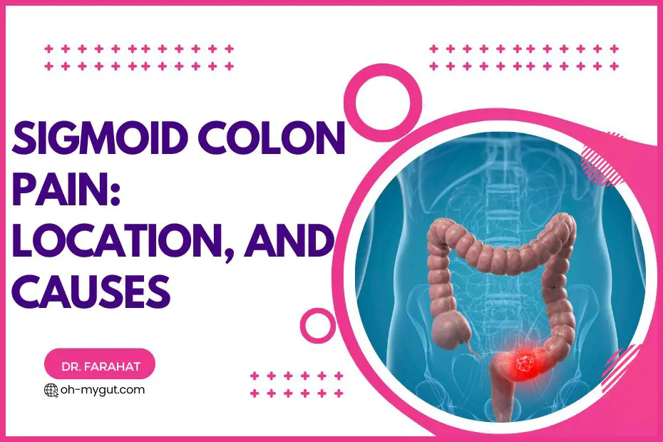 Sigmoid Colon Pain: Location, and Causes (Gastroenterologist Explains ...